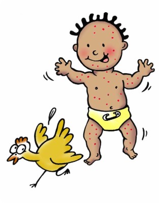 A Pox On Both My Homies - Chickenpox Cartoon - 769x980 Wallpaper ...